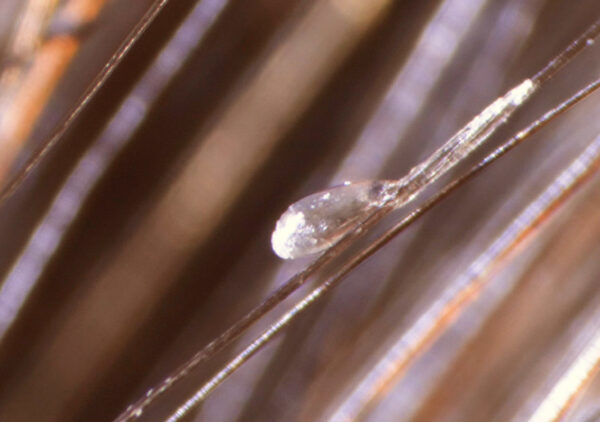 Pricing & Services | Torrance Lice Removal